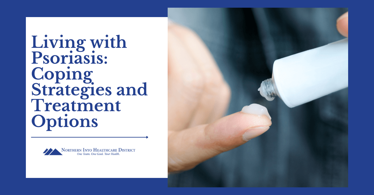 Living with Psoriasis: Coping Strategies & Treatment Options